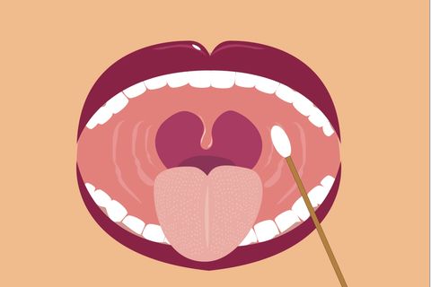 Nasen-Rachen-Test selber machen: So geht's | BRIGITTE.de