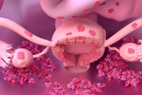Nach hinten gekippte Gebärmutter: Was ist retroflexio Uteri? | BRIGITTE.de
